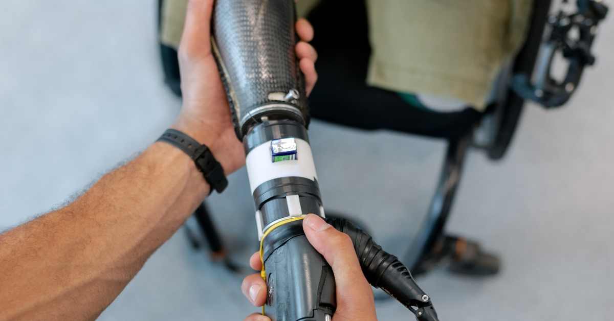 Watch The Gripping Story Behind The World's Most Affordable Bionic Hand ...